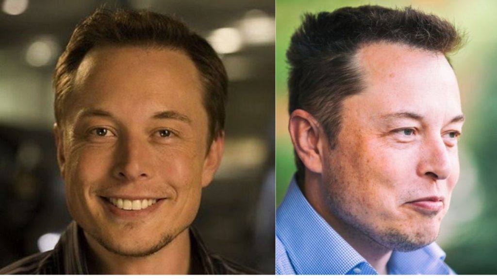 Elon Musk's Hair Transformation: What he may have done? - The Tech Outlook